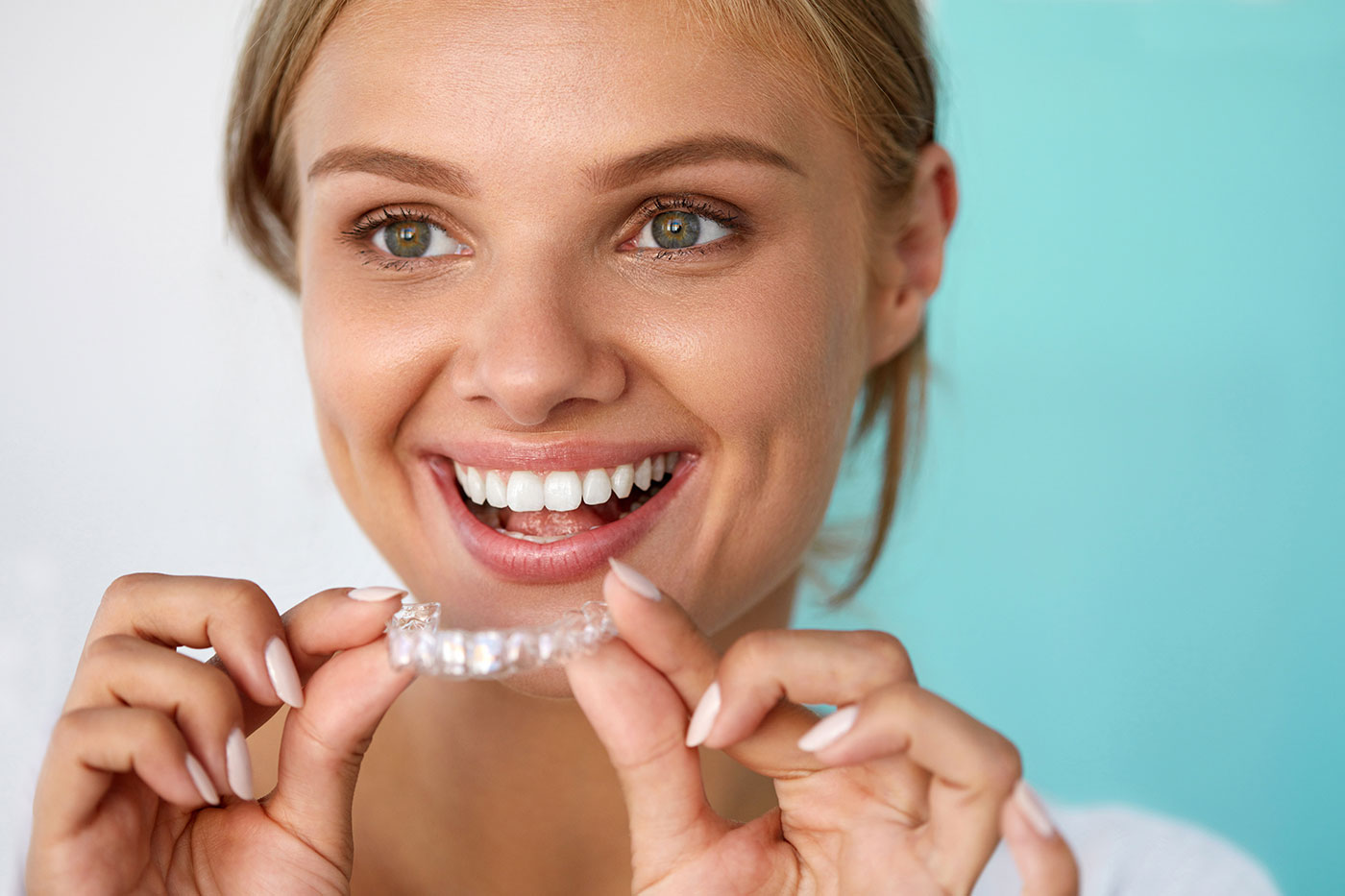 Straighten your teeth in 6 months with Invisalign or dental braces ...