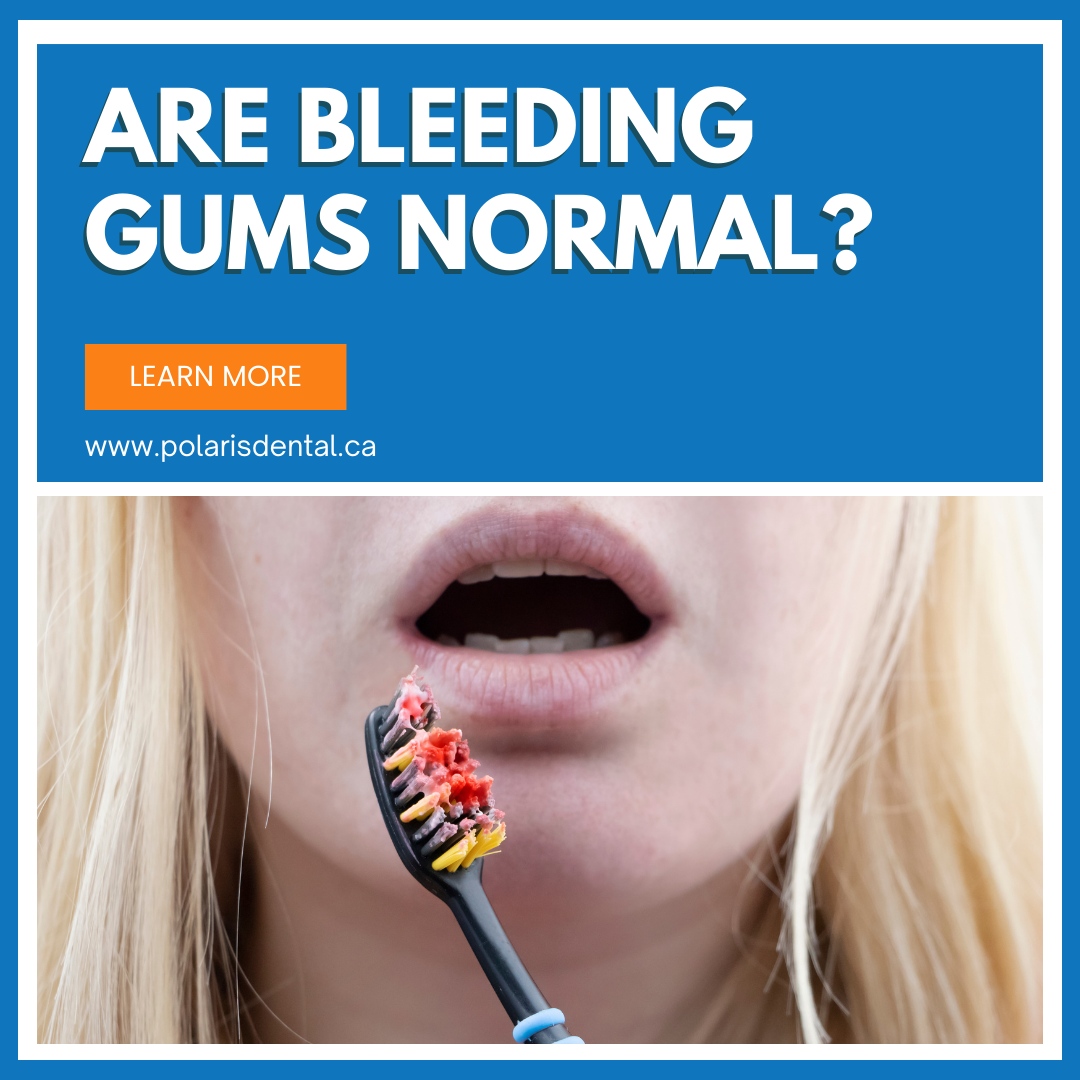 Have bleeding or swollen gums? get your gum disease under control and ...
